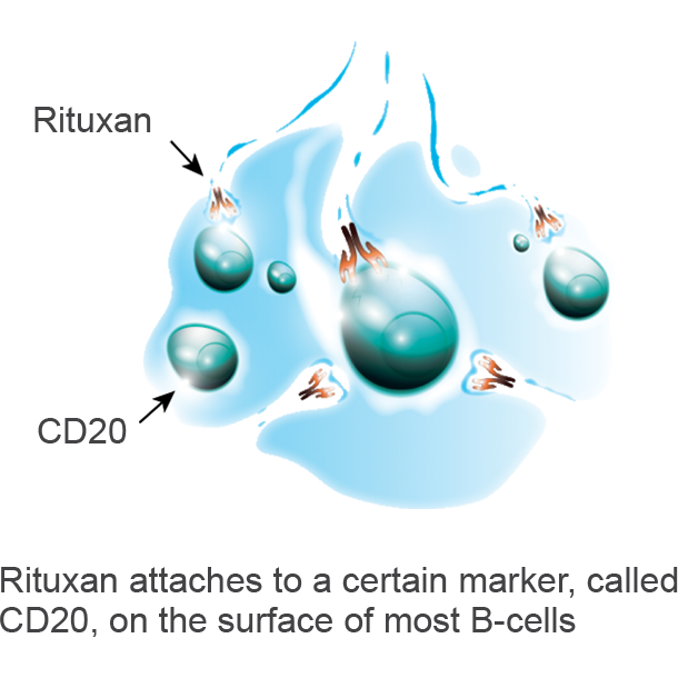 What is RITUXAN® (rituximab) for GPA and MPA?